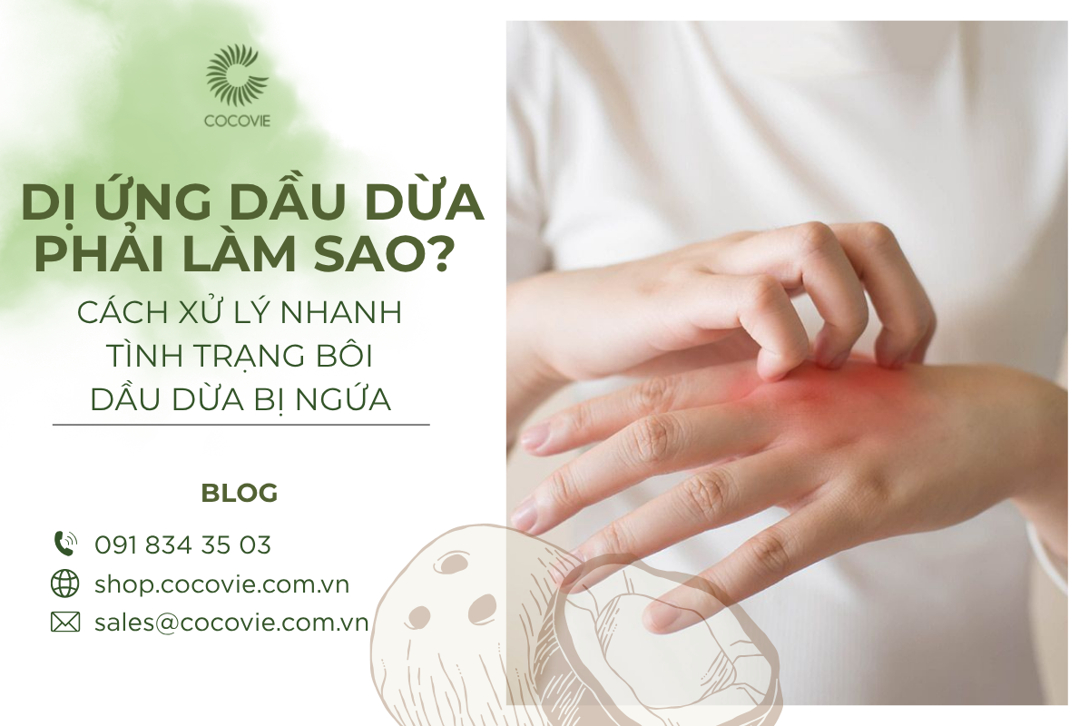 Dị ứng dầu dừa phải làm sao? Cách xử lý nhanh tình trạng bôi dầu dừa bị ...